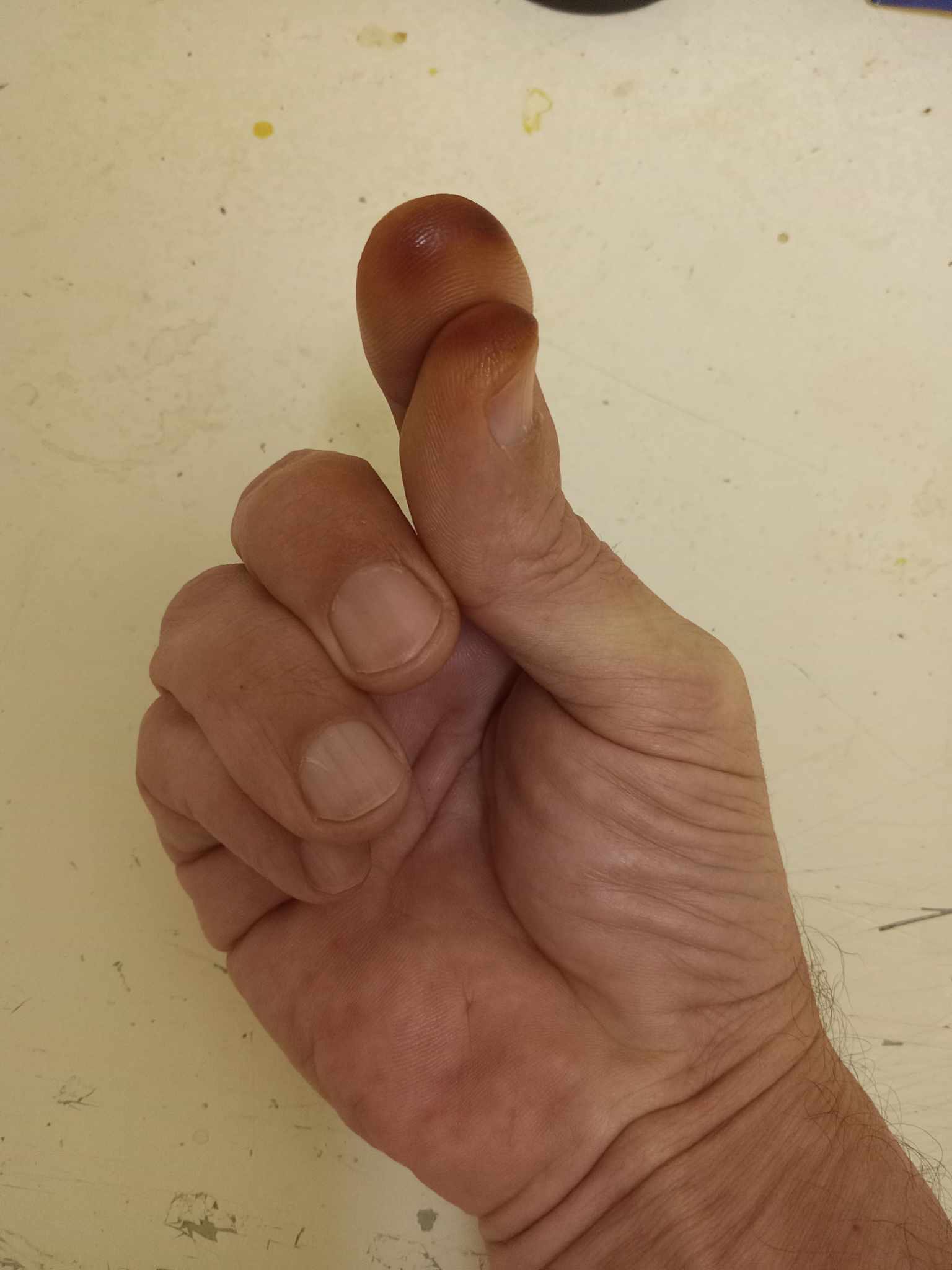 Smoking in Prisons Has Changed. Why Are We Denied Lung Cancer Screens?