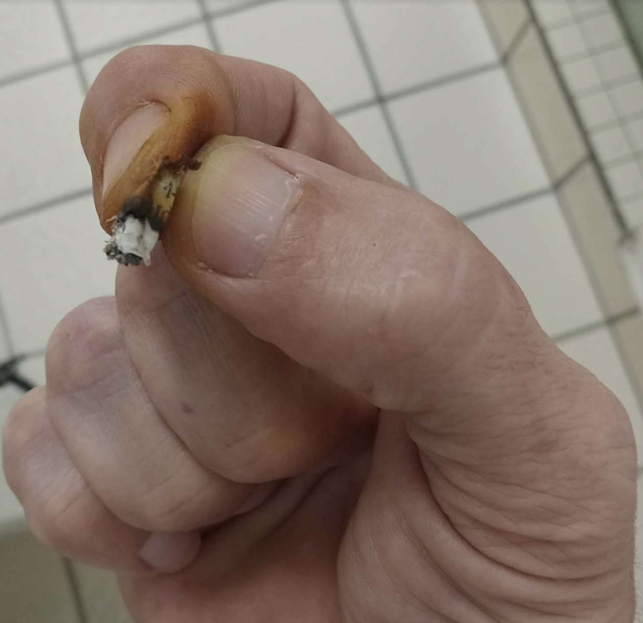 Smoking in Prisons Has Changed. Why Are We Denied Lung Cancer Screens?